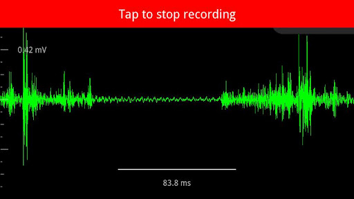 برنامه Spike Recorder - دانلود | کافه بازار